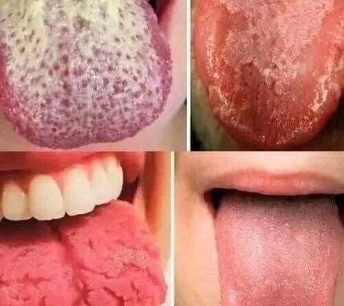 Lo Que Tu Lengua Revela Sobre Tu Salud: Señales y Consejos – Bienvenido ...